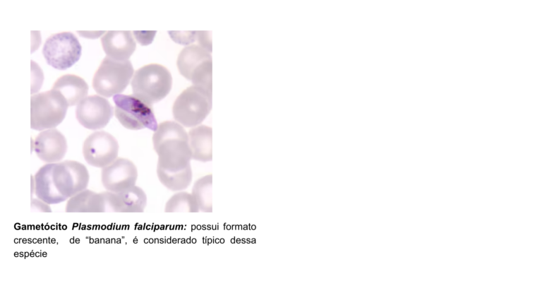 PLASMODIUM SP. – Atlas de Parasitologia
