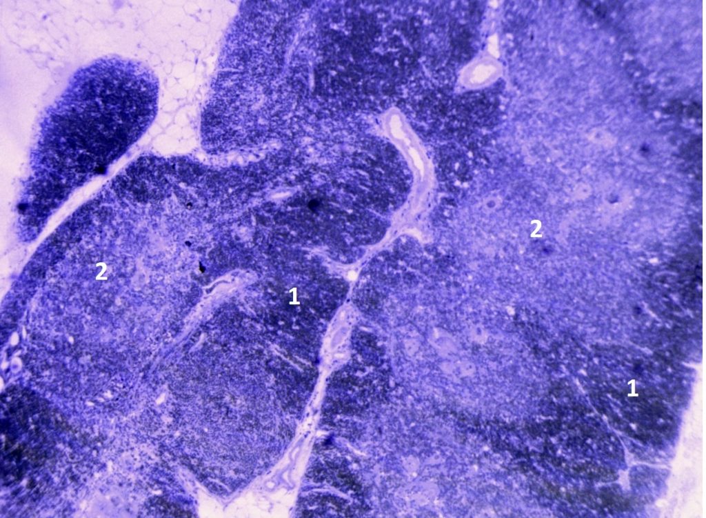 Timo – Histologia Interativa