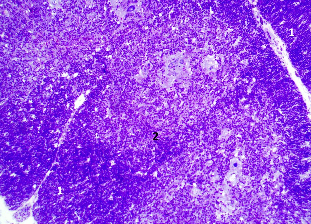 Timo – Histologia Interativa