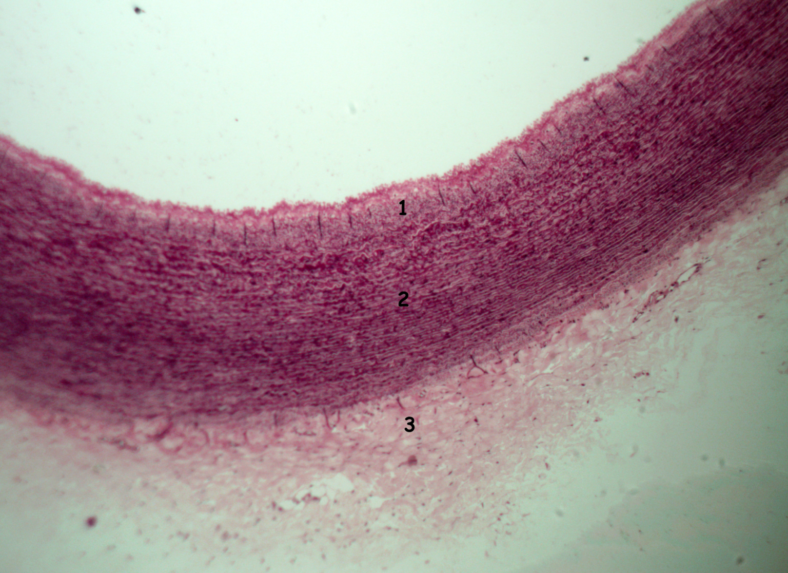 Artéria elástica – Histologia Interativa