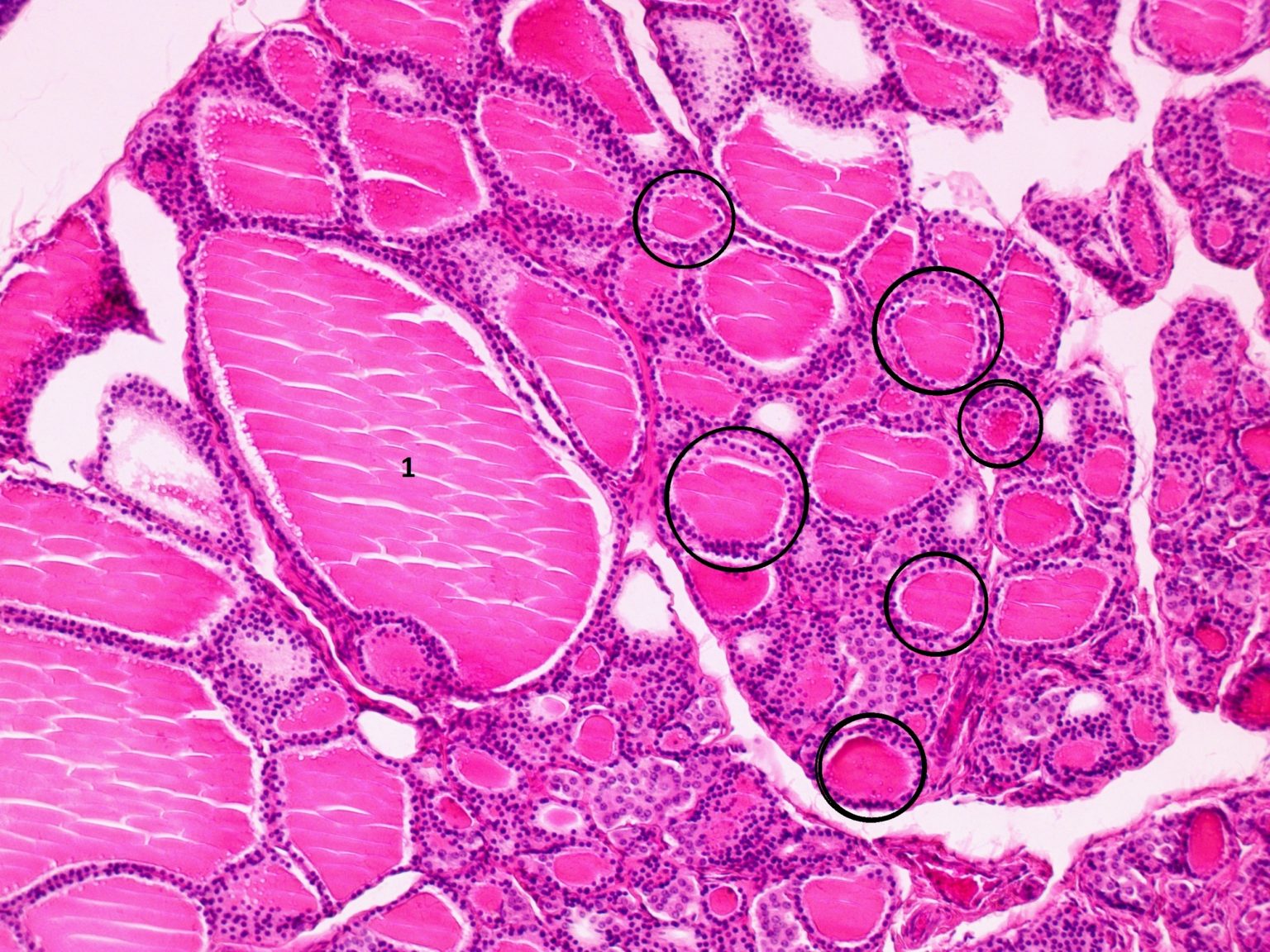 Tireóide- Hematoxilina e Eosina – Histologia Interativa