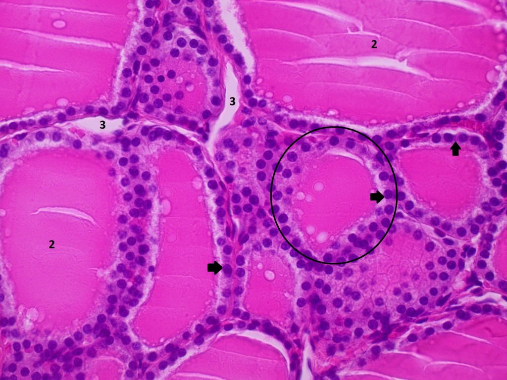 Tireóide- Hematoxilina e Eosina – Histologia Interativa